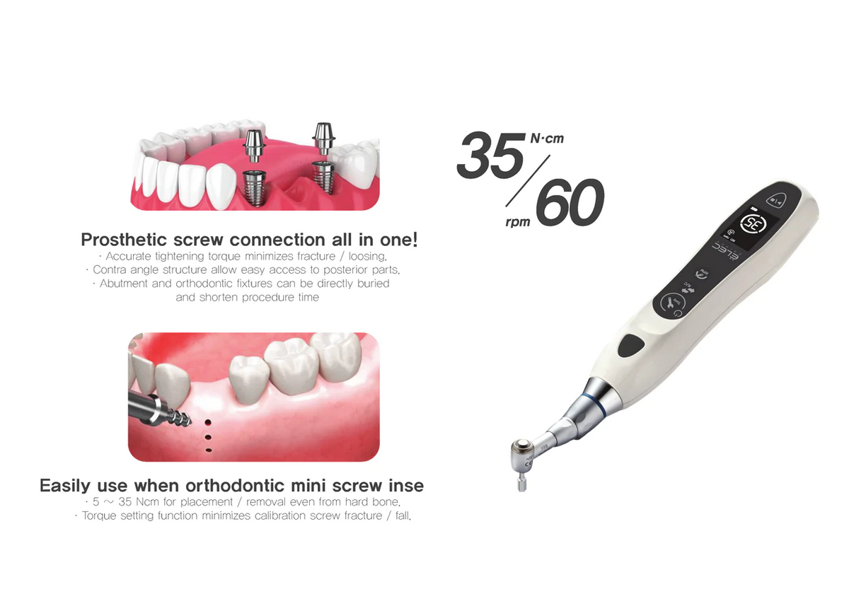 Electric Wireless Torque Driver, NX-TORQ – DoWell Dental Products, Inc.